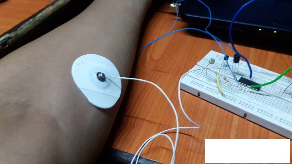 Electrodo Electrocardiografo ECG AD8232 Motiroreo Ritmo Cardiaco - yorobotics